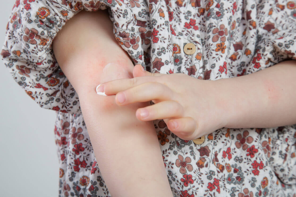 Questions to Ask Your Pediatric Eczema Specialist | Happy Skin